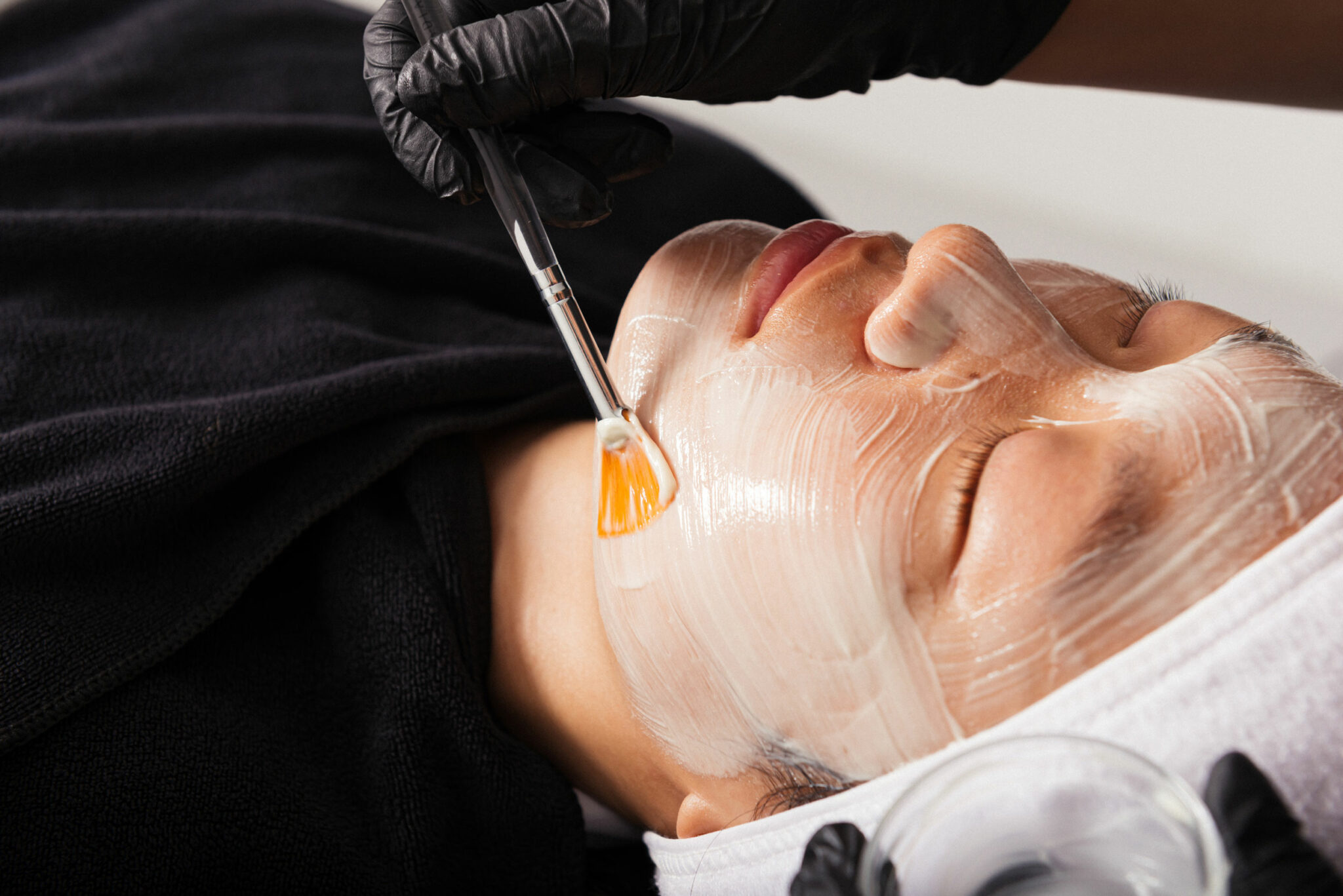Peelings by Skin Tech – Amsterdam Cosmetic Clinic